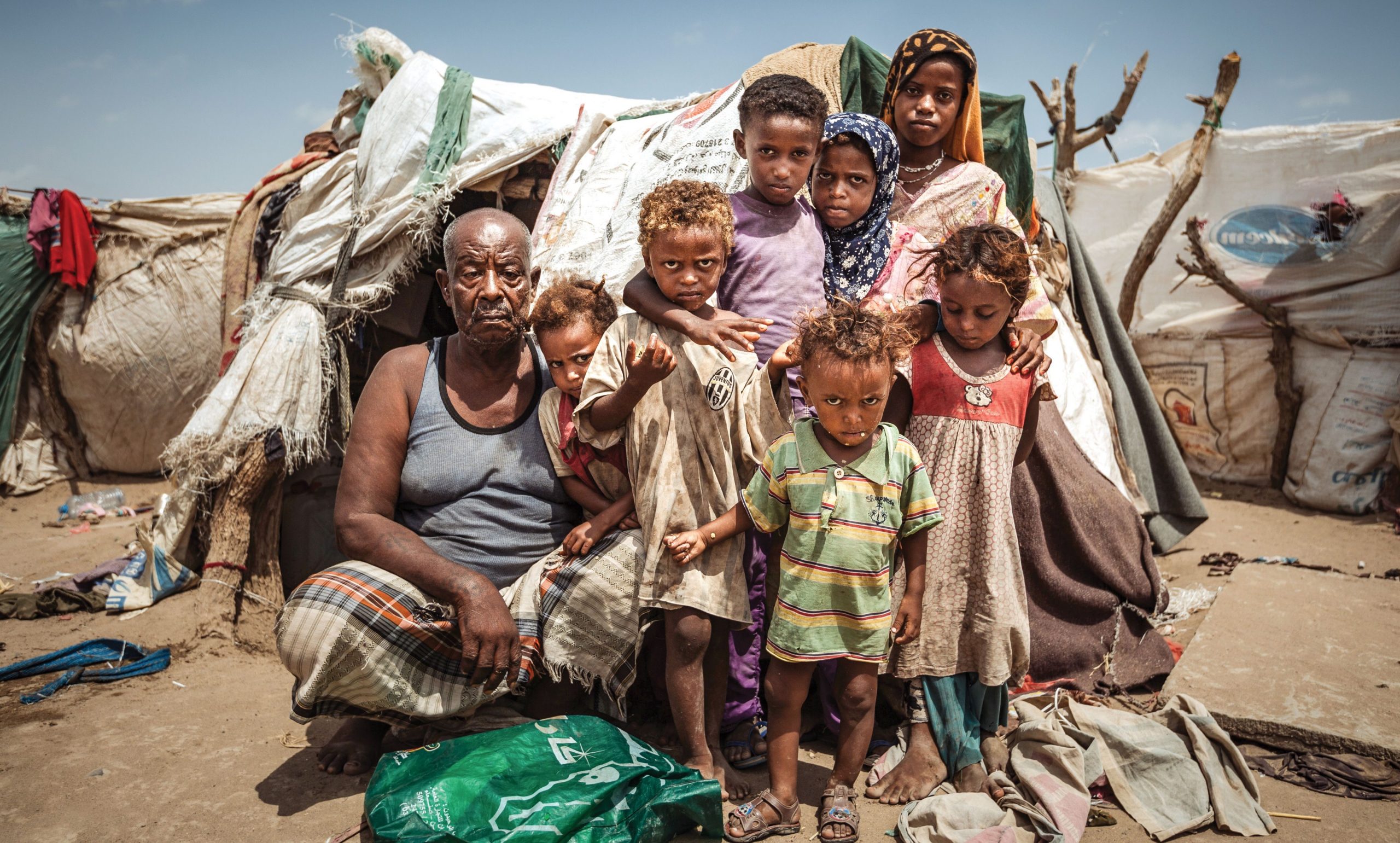 ‘Disappointing’ aid for hunger-stricken Yemen – CounterVortex
